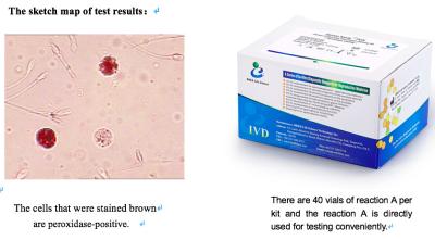 China Semen Sample Leukocytes Test Kit 40T/Kit For Male Reproductive Tract Infection Screening for sale