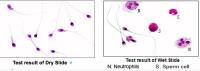 China Blood Cell Morphology Test Pre Stained Slides for sale