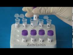 Eenvoudig te bedienen mannen-vruchtbaarheidstestkit Sperma leukocyten-testkit Peroxidase-kleuring