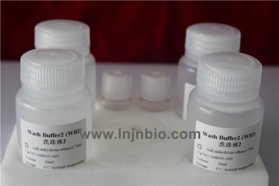 China High quality Whole Blood Genomic DNA Extraction Kit (magnetic beads method) for sale