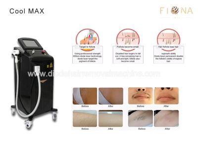 Cina Trattamento permanente indolore dell'annuncio pubblicitario del laser della macchina sicura veloce di depilazione in vendita