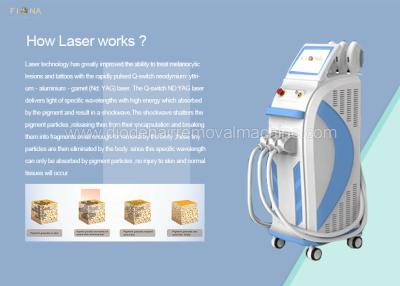 중국 기계, E 빛 Ipl 기계 몸 윤곽을 그리기를 바짝 죄는 휴대용 Rf 피부 판매용