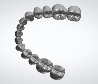 China Restoration EXO Dental Design Service Dental Brace Crown Dental Interior Design for sale