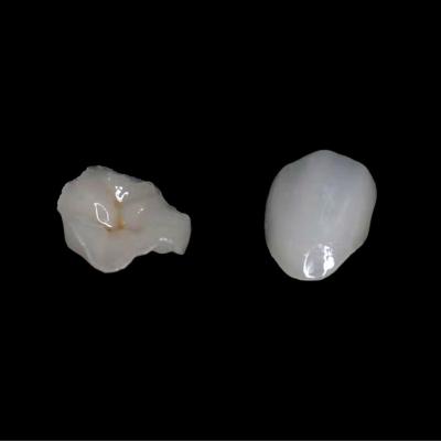 Cina Ceramiche dentali in vetroceramica per estetica Cera Beaming, corone in vetroceramica, materiali di consumo dentali in vendita