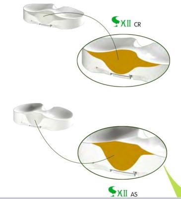 China CoCrMo SKII Tibial Tray Artificial Knee Joint for sale