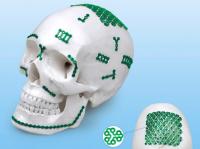 China 80mm Cranial Titanium Plate Skull Three Dimensional Shaping for sale