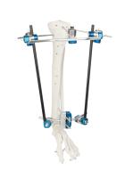 China SS Blue Ortho External Fixator Cross Clamp Class I Class III for sale