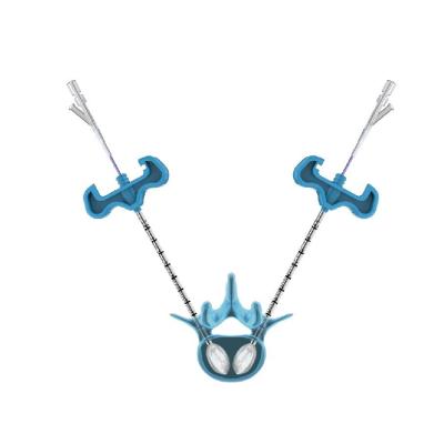 中国 プロフェッショナル パークタヌス キフォプラスティ システム PKP 脊椎整形キット 販売のため