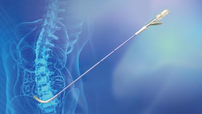 Cina Percutaneous Curved Kyphoplasty System PCKP Punzione unilaterale integralmente formante in vendita
