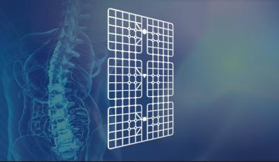 Cina Percutaneous Curved Kyphoplasty System Plate di posizionamento tecnica semplice in vendita