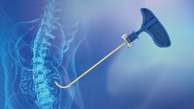 Cina Sistema di Vertebroplastica Curva Percutanea PCVP Cannula di Consegna Curva in vendita