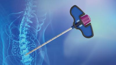 Cina Kit di ago per la vertebroplastica per il sistema percutaneo curvo di vertebroplastica in vendita