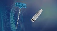 China Percutaneous Kyphoplasty System PKP Dilation Kit Surgical Instruments for sale