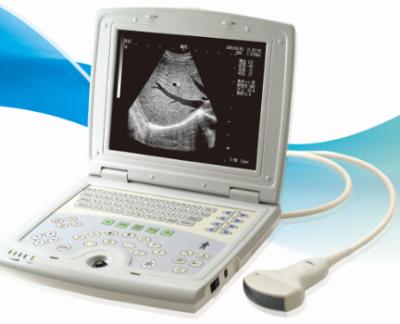 China laptop ultrasound scanner for human for sale