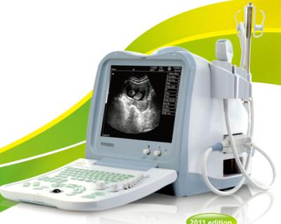 China KX2600 portable human dignostic scanner for sale