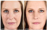 China Lifting and Firming Skin for sale