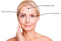 China Botoxinjection Botulax and Meditoxin for sale