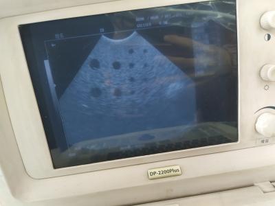 中国 2級超音波ミンドレイ専門家妊娠スキャナー 65C15EA 画像撮影用の微積形探査機 販売のため