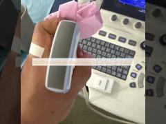 GE  Ultrasound Probe Repair Service Transducer Lens Change