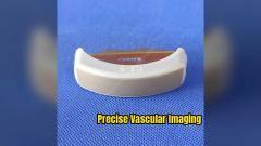 Vascular Ultrasound Scanhead High Resolution Imaging