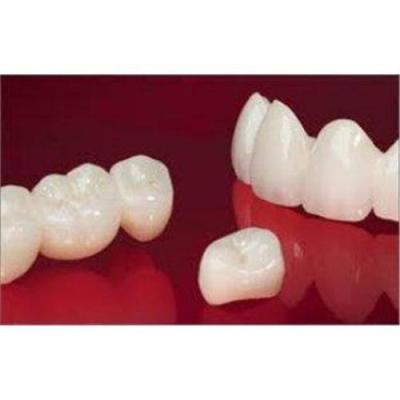 China CAD / CAM Dental Zirconia Crowns Restorations Dental Lab With Computer Assist for sale