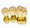 China Captek Alldental noble metal PFM Dental Crown for sale