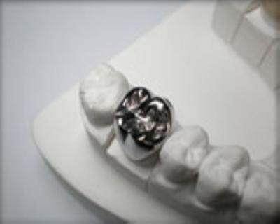 China Full Metal Crowns (YS-FM) No foreign body sensation for sale