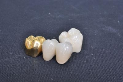 China Germany Bego Co-Cr alloy PFM porcelain teeth for sale