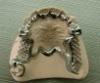China removable partial metal dental framework for sale