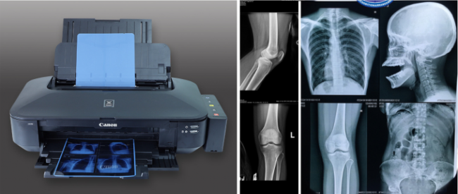 Stunning Blue Xray PET Medical Film - For Image Sheet Roll Inkjet Printer