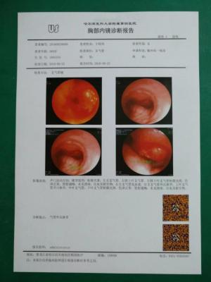 Cina PET Based 125um 150um 180um Medical Dry Film White Inkjet X Ray Film OEM in vendita