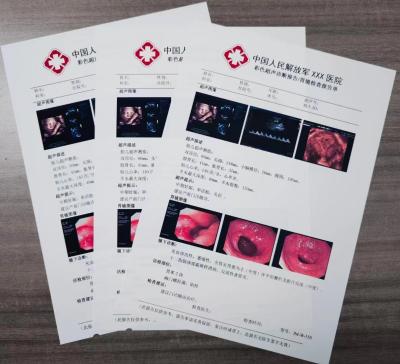 China 180 Microns White Glossy 17"X30m Inkjet X Ray Film Eco Friendly for sale