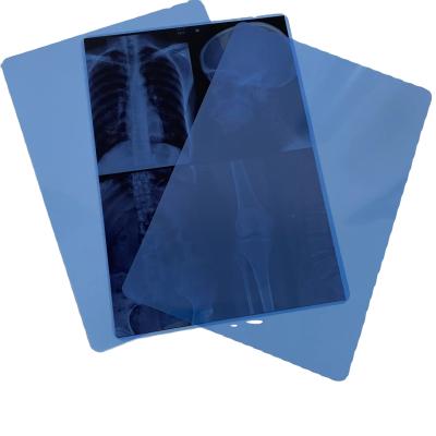Cina OEM Radiology PET X Ray Film 11x14 Inch Toner Laser Printing Medical Blue Film in vendita