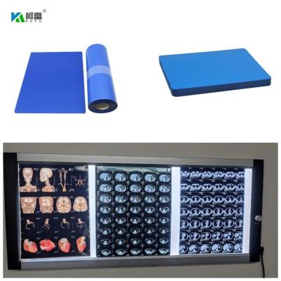 Cina 210 Micron Inkjet X Ray Medical Blue Base Dry Film 8x10 13x17 14x17 A4 A3 100 Sheets in vendita