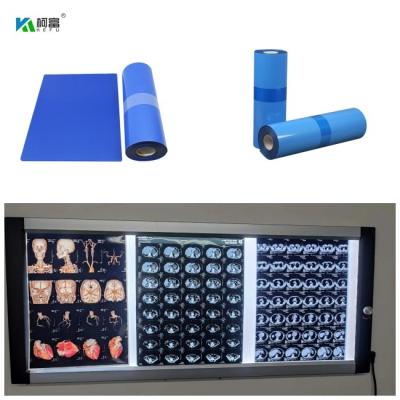 Chine Medical 210um Inkjet Blue X Ray Film For Digital Image Output Fuji Agfa With Sheets à vendre