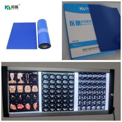 Chine Compatible 210um Inkjet Medical X Ray Film Blue For Digital DR CT MRI With Rolls à vendre