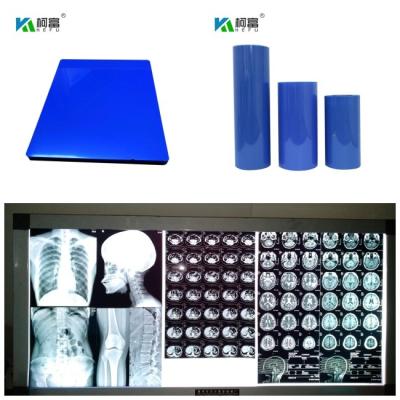 Cina 280gsm Medical Dry Inkjet X Ray Film Blue Base Digital Color Image Output in vendita