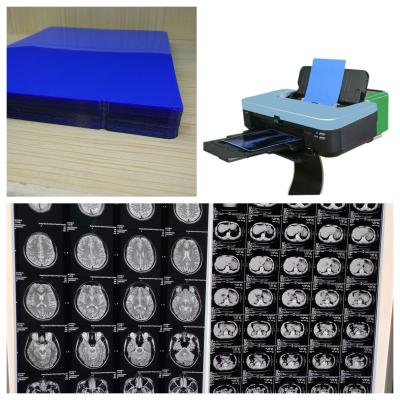 Cina 210 micron PET Inkjet X Ray Film 14 pollici con alta stabilità dell'immagine in vendita