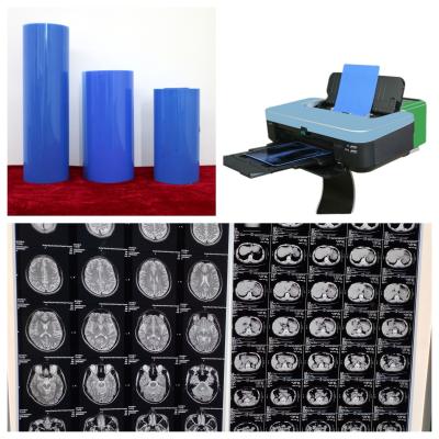 Cina Pellicola medica opaca bianca a getto d'inchiostro con finitura di superficie lucida 11x14 in vendita