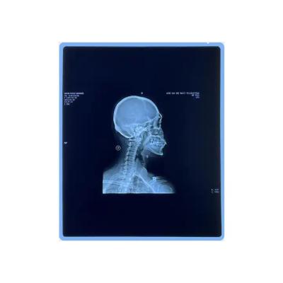 Cina Film asciutto per raggi X medici Film a getto d'inchiostro per raggi X medici con qualità di immagine chiara in vendita