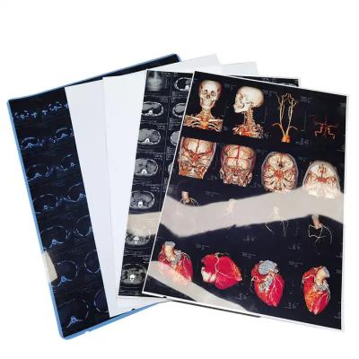 Cina Prodotto all'ingrosso Film medico a getto d'inchiostro trasparente bianco blu / laser Film a raggi X in vendita