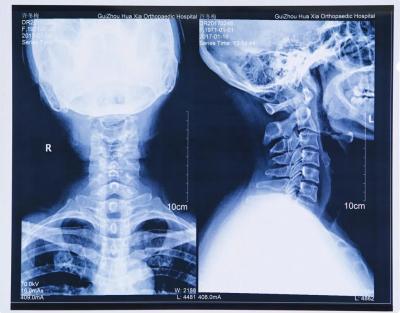 China Blue Laser Medical Dry Sexy X Ray Bf Film For Radiography Examination à venda