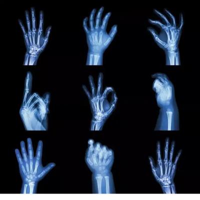 China Laser Dry X Ray Film Compatible For Fuji Drypix Laser Printer 4000 6000 7000 Medical Laser Printer for sale