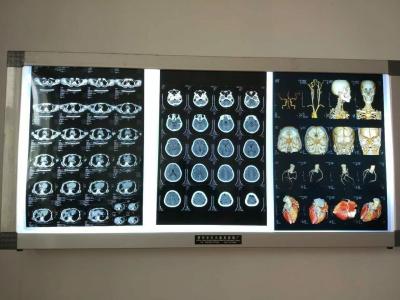 Cina Waterproof X Ray Dry Film Imaging For Medial Devices Laser Inkjet Printing in vendita