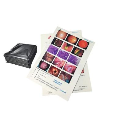 Cina Low Fog Medical X Ray Films High Resolution For Enhanced Diagnostic Precision in vendita