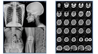 Cina Pellicola radiologica medica pellicola termica secca per immagini chiare in vendita