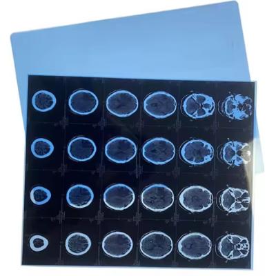 Cina Prodotto all'ingrosso Film medico a getto d'inchiostro trasparente bianco blu / laser Film a raggi X in vendita