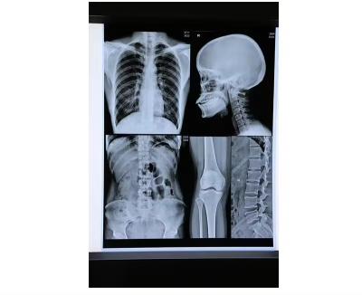 Cina Blue Inkjet Medical X Ray Film Medical Dry Film A4 Sheet Or In Roll Nessuna recensione ancora in vendita