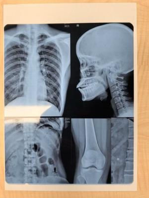 Chine Réglage automatique de la densité du film laser à rayons X pour l'imagerie médicale à vendre
