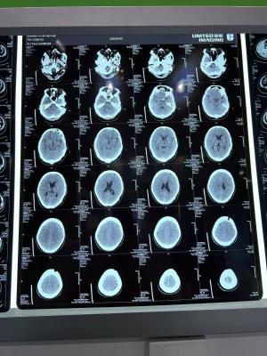 Chine 3.0D Contraste supérieure de la flexibilité du film laser sec aux rayons X pour les soins médicaux à vendre